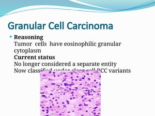 Nomenclature of Renal Cell Carcinoma and its Reasoning | PPTX
