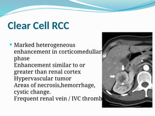 Nomenclature of RCC according to its histopathology.pptx
