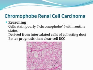 Nomenclature of RCC according to its histopathology.pptx