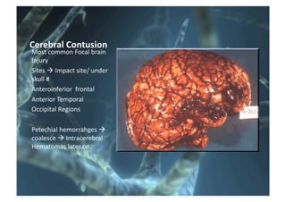 Non accidental head injury - how to improve outcome | PDF