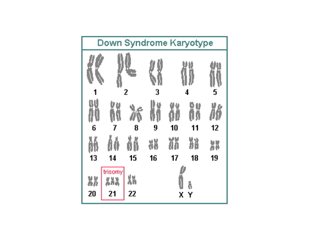 Non disjunction & disorders | PPTX | Infertility | Reproductive Health
