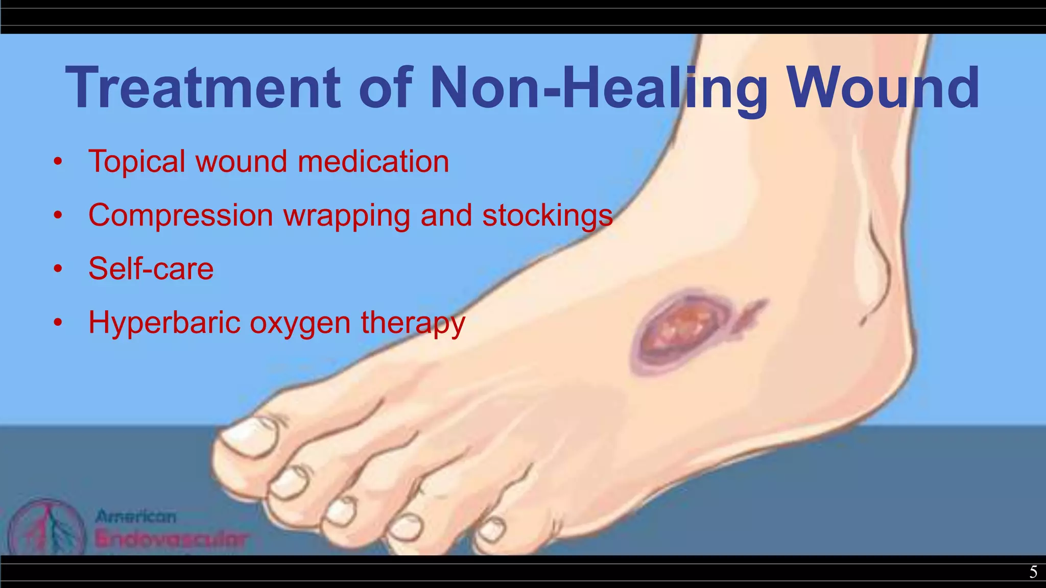 Non Healing Wound | PPT
