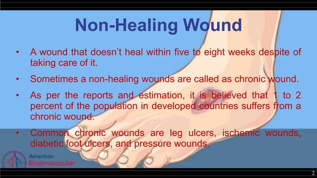 Non Healing Wound | PPT | Foot Health | Diseases and Conditions
