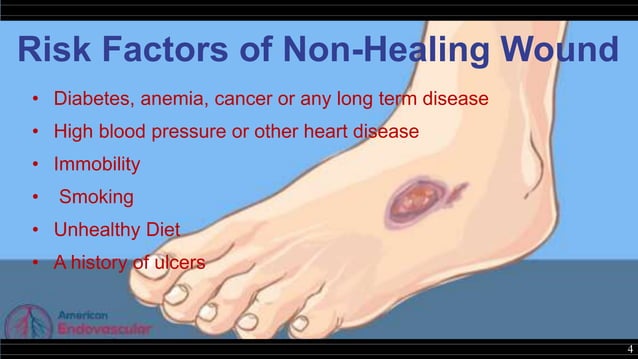Non Healing Wound | PPT | Foot Health | Diseases and Conditions