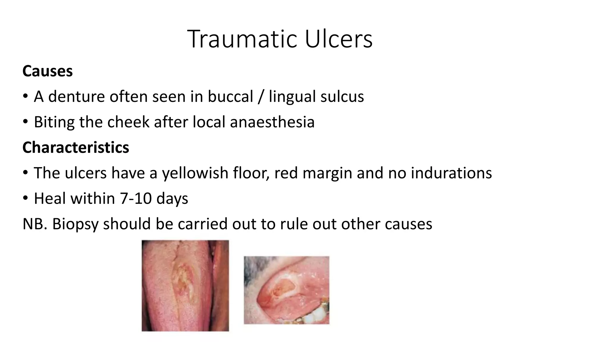 Non infectivive stomatitis [autosaved] | PPTX