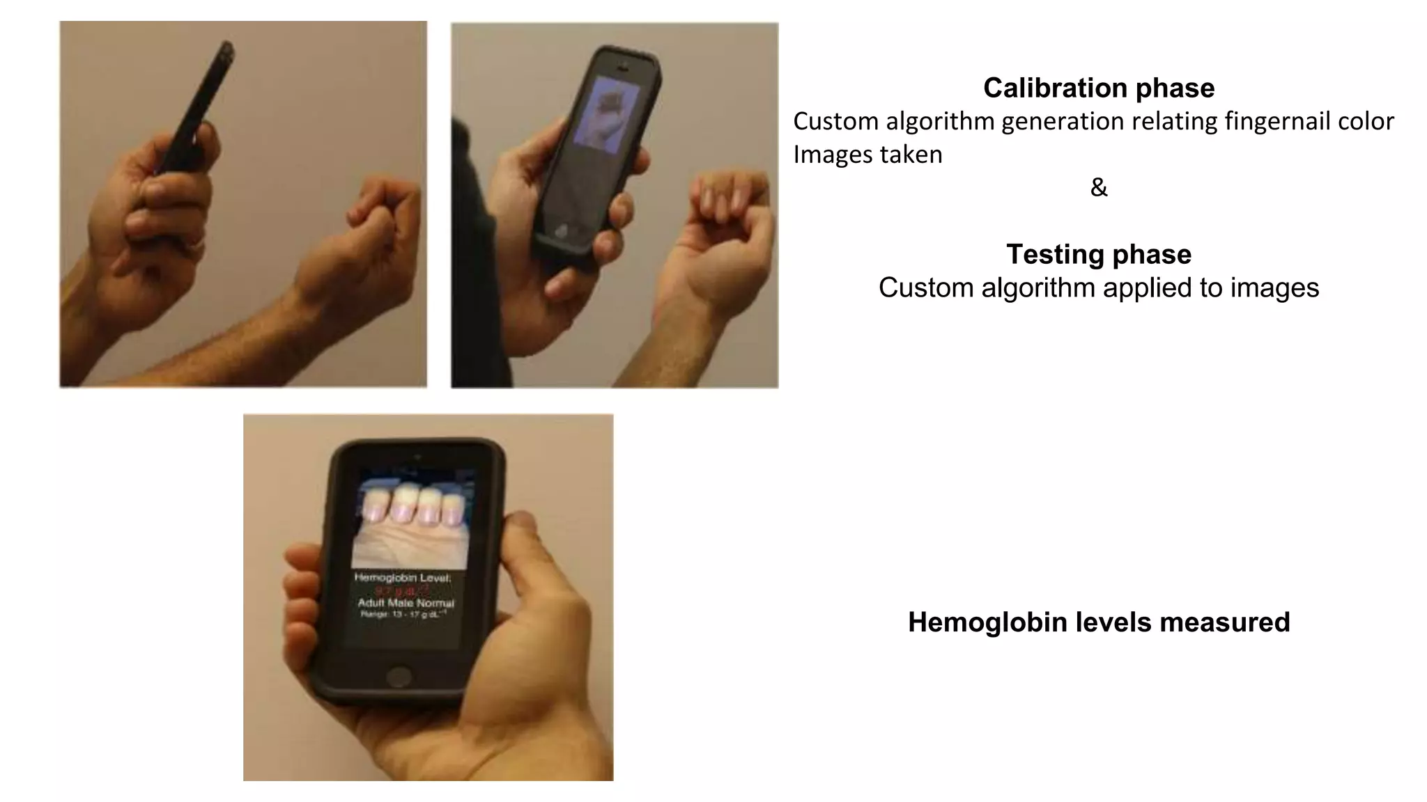 Non invasive anemia screening- Mobile apps | PPTX