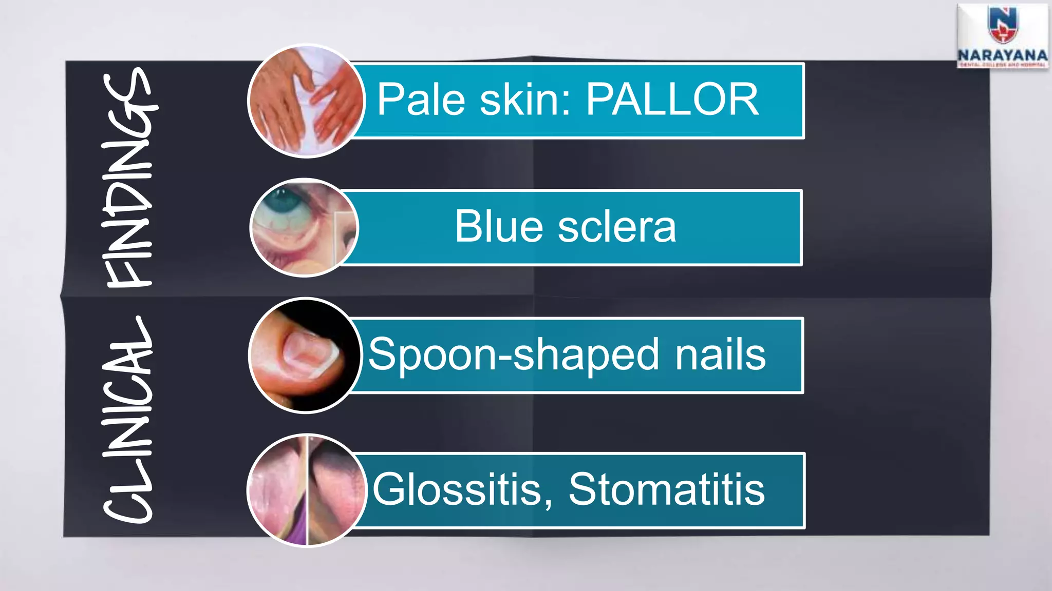 Non invasive anemia screening- Mobile apps | PPTX