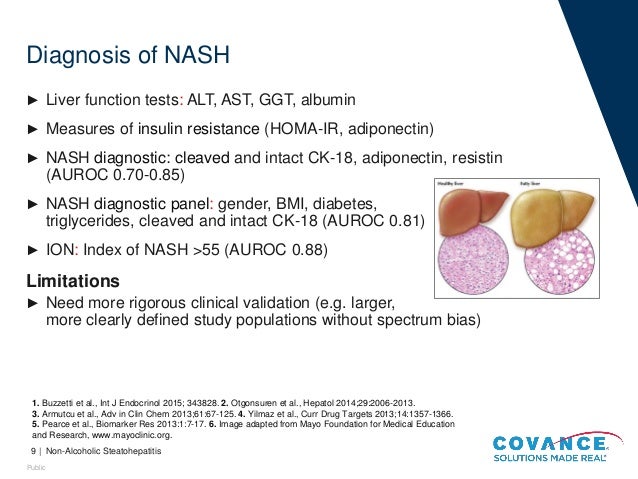 Non Invasive Biomarkers in NASH (non-alcoholic steatohepatitis) Webin…