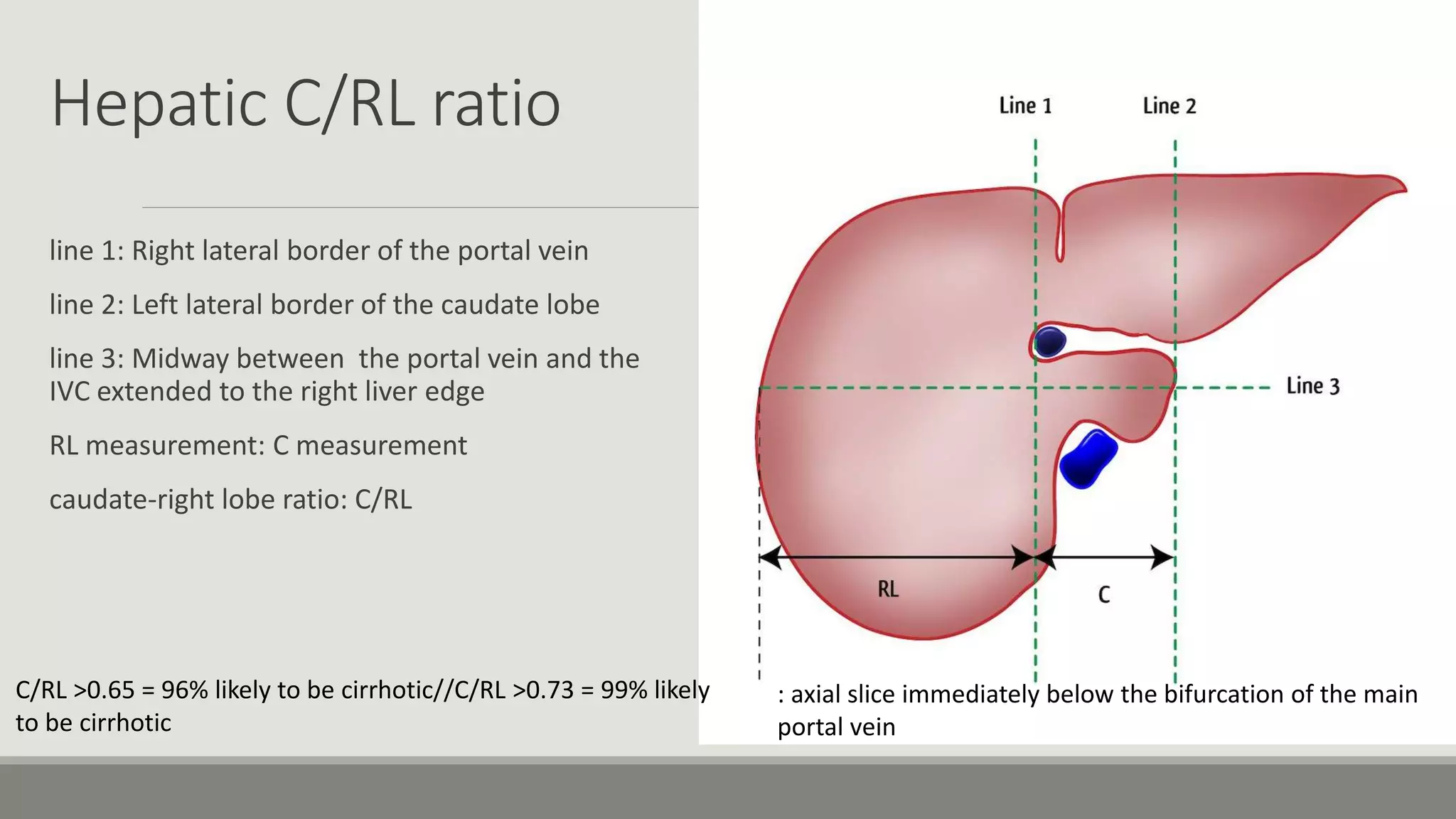 Imaging of portal hypertension | PPTX