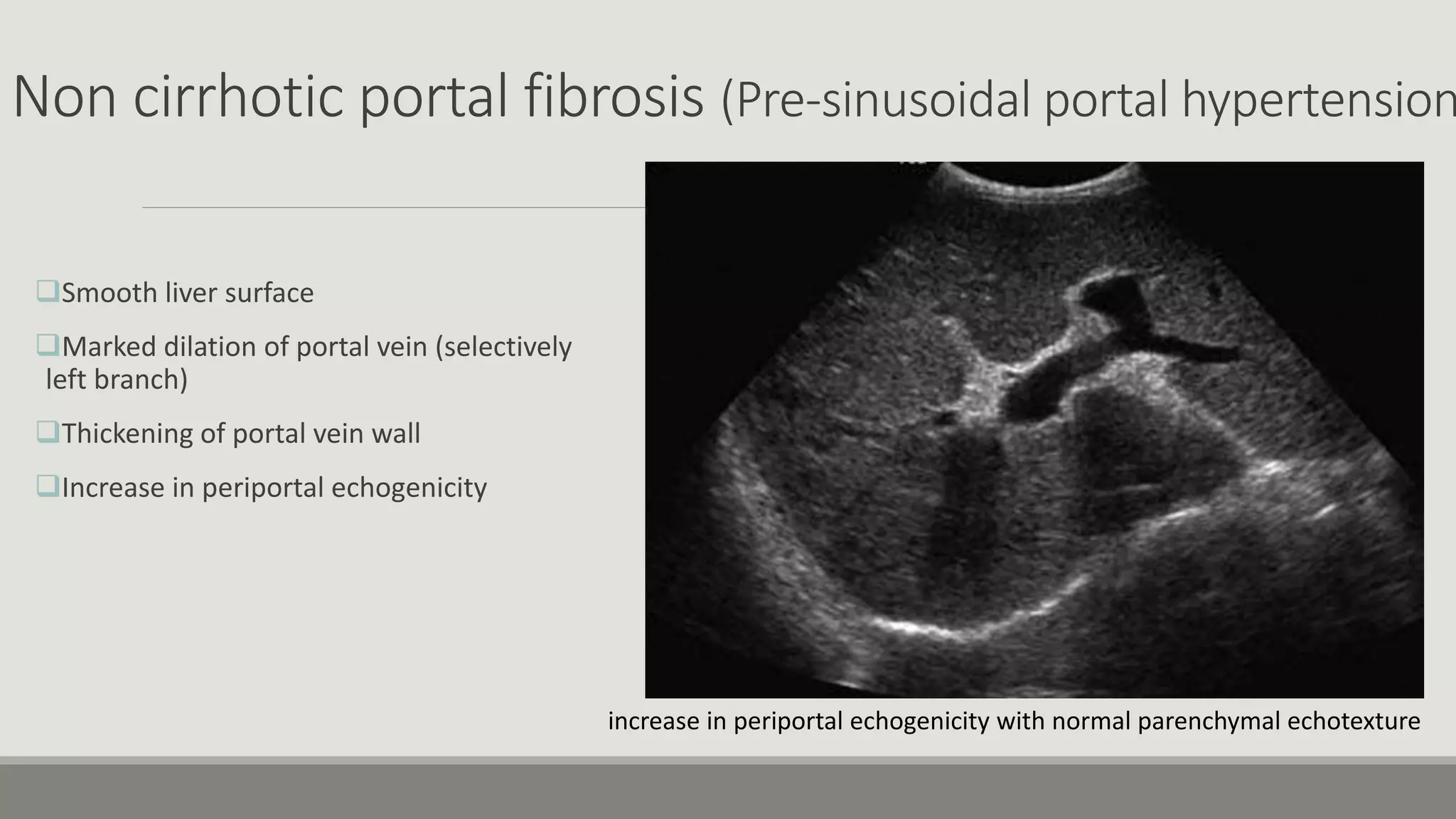 Imaging of portal hypertension | PPTX