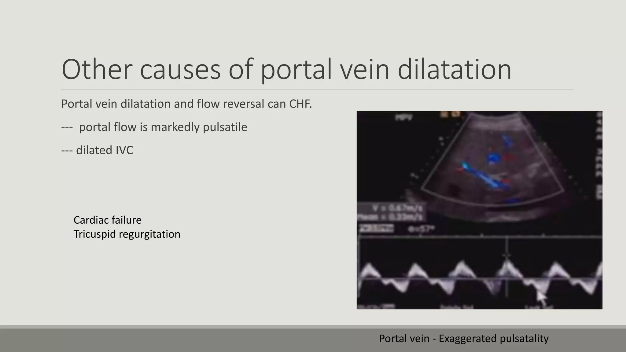 Imaging of portal hypertension | PPTX