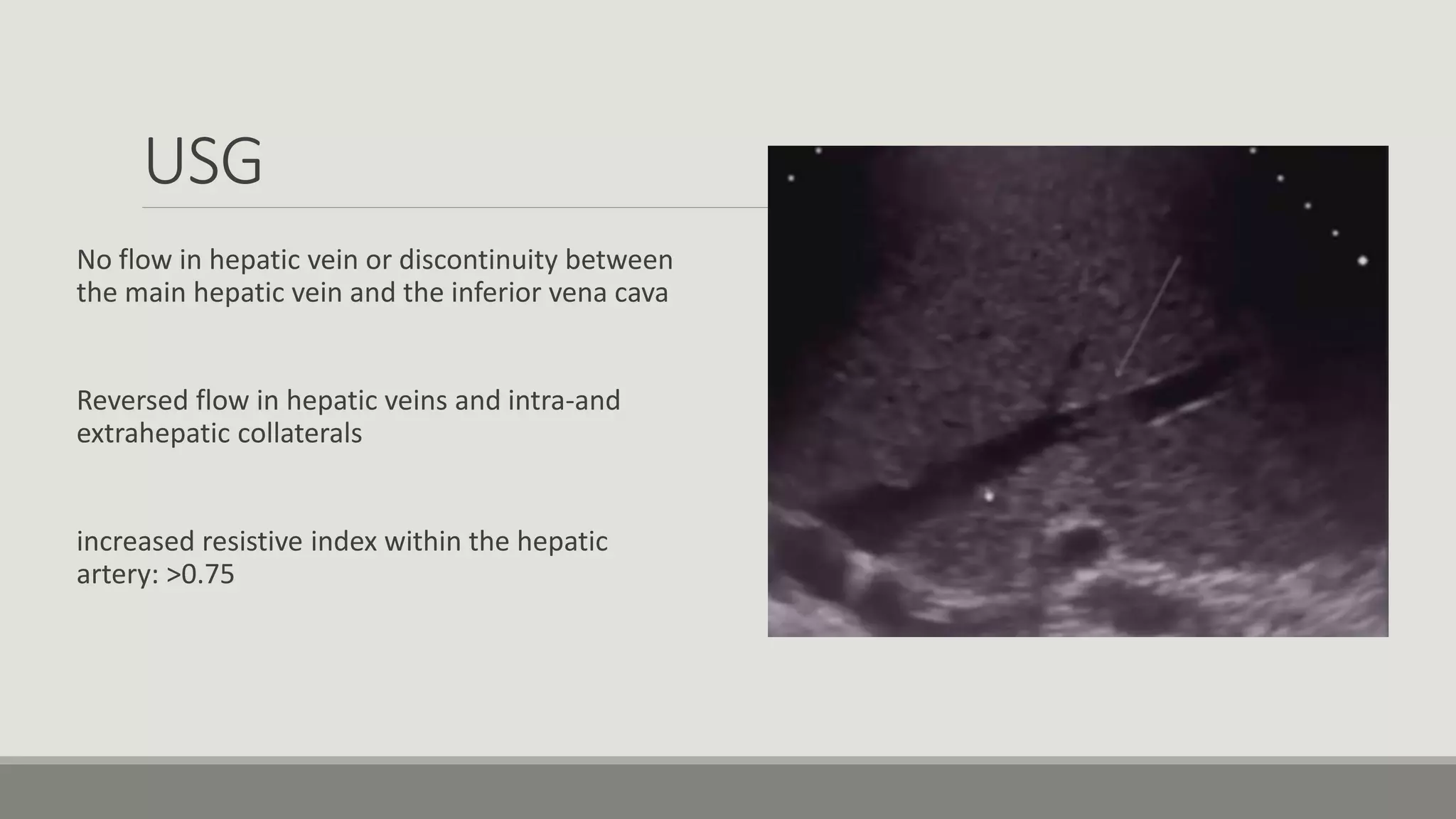 Imaging of portal hypertension | PPTX