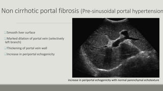 Imaging of portal hypertension | PPTX