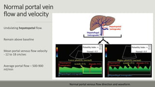 Imaging of portal hypertension | PPTX