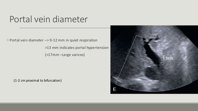 Imaging of portal hypertension