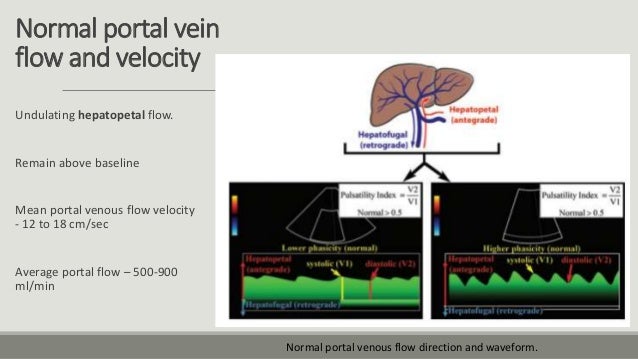 Imaging of portal hypertension