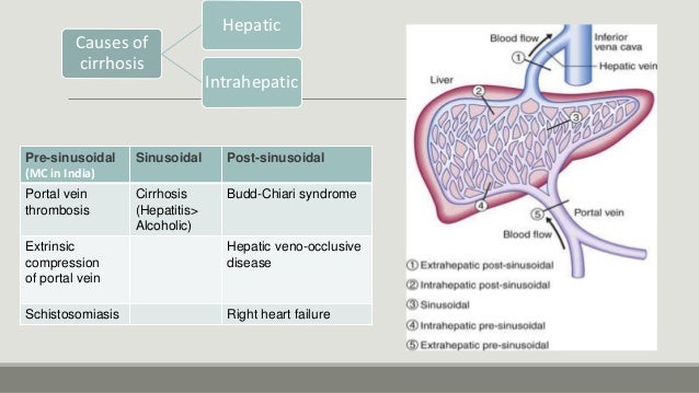 Imaging of portal hypertension