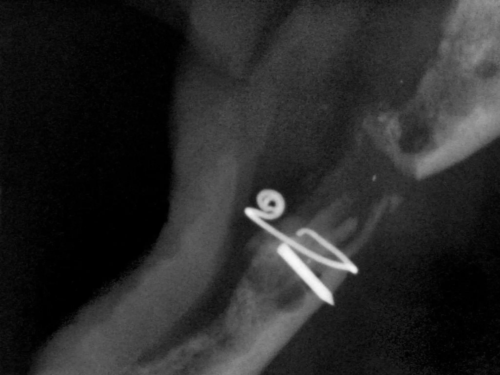 Veterinary Dentistry - Non Invasive Mandibular Fracture Repair in Dogs ...