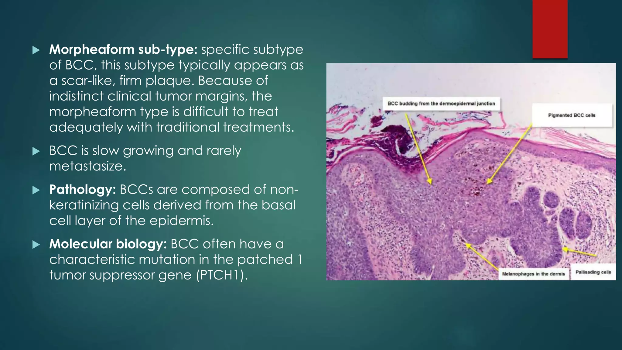 Non-melanoma skin cancer | PDF