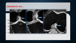 Radiological study of non meniscal knee joint pathology by dr ...