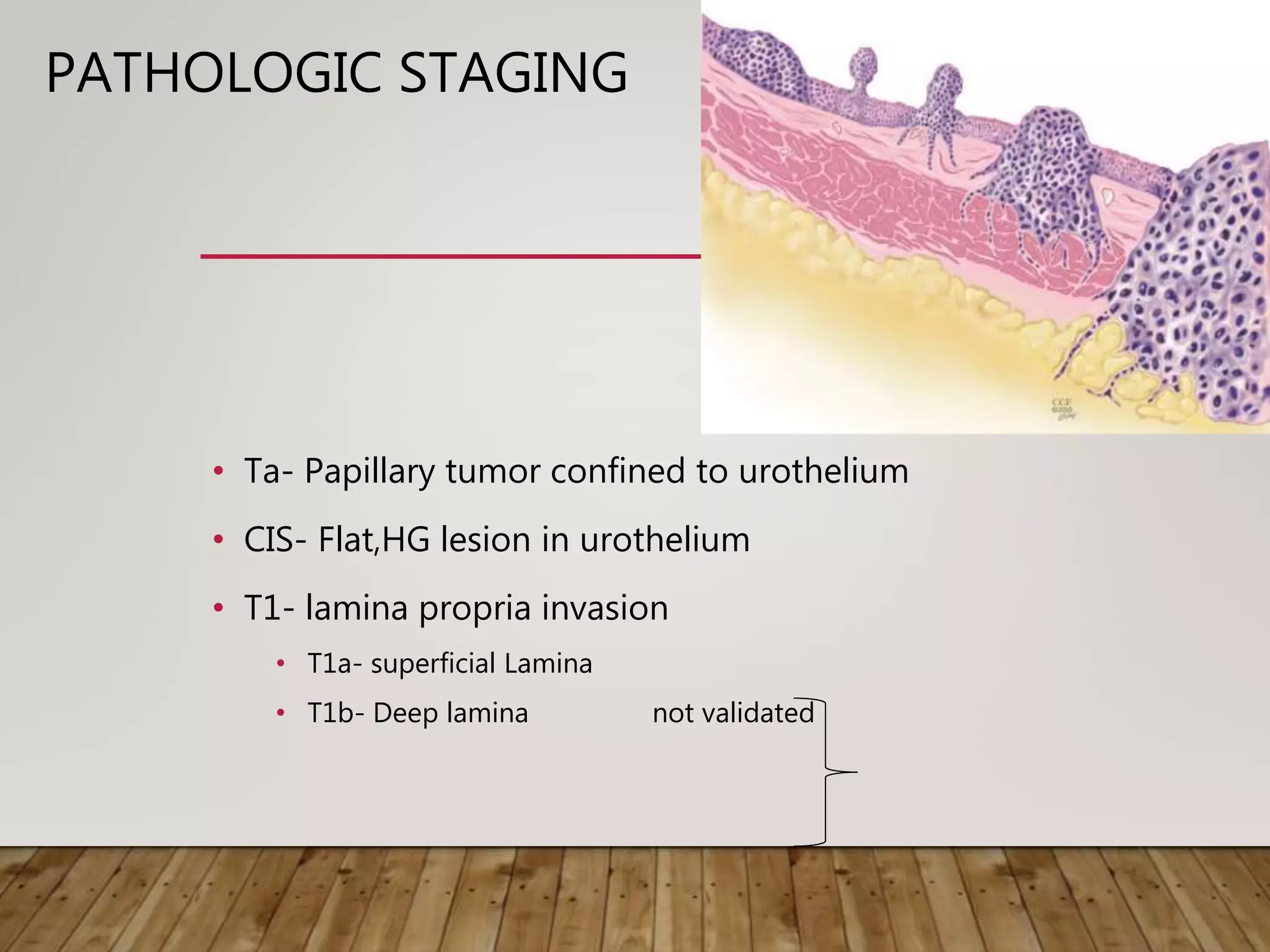 Non muscle invasive bladder cancer | PPTX