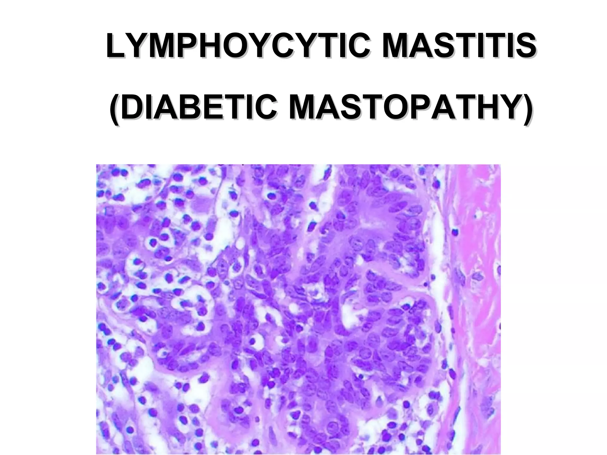Non neoplastic breast diseases | PPT