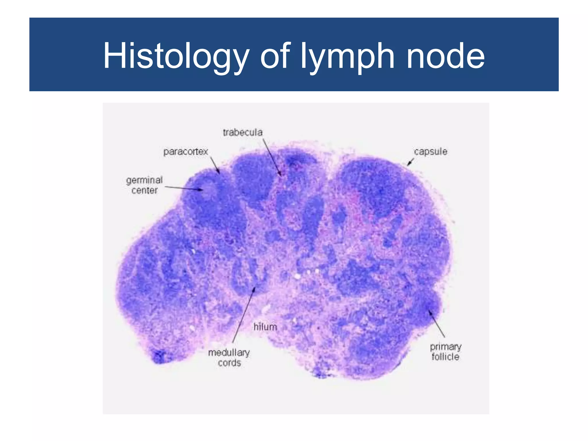 Non neoplastic lesions of lymph node | PPTX