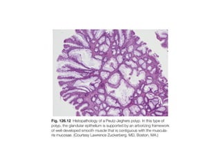 NON-NEOPLASTIC POLYPS AND POLYPOID LESIONS .pptx