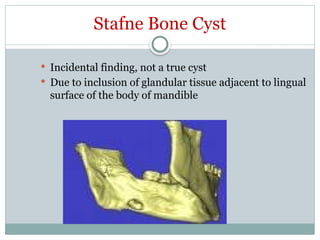 Seminar slide Non-Odontogenic-cysts-VI.pptx