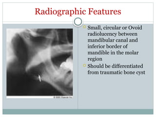 Seminar slide Non-Odontogenic-cysts-VI.pptx