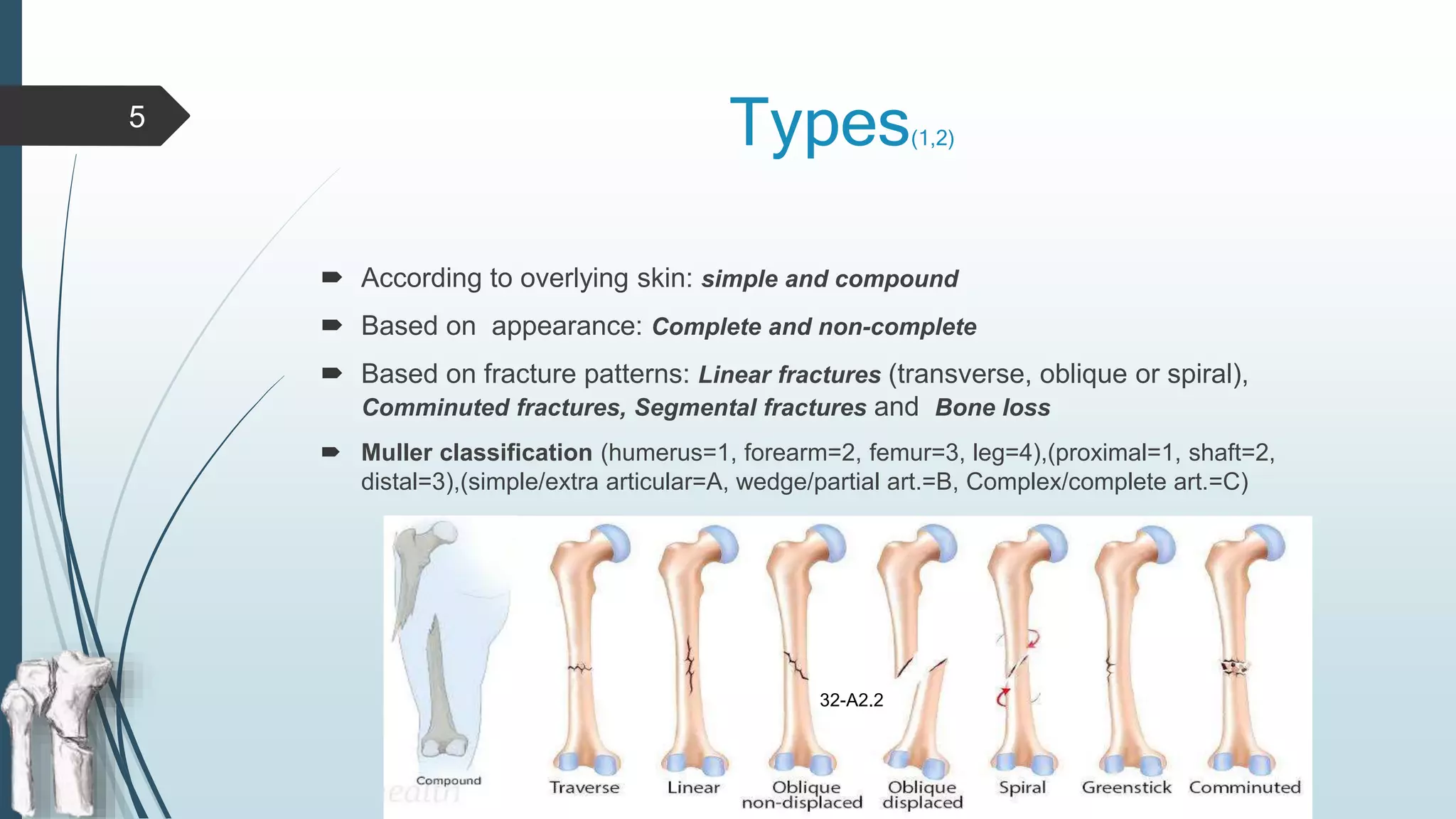 Non operative management of fractures | PPTX
