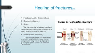 Non operative management of fractures | PPTX