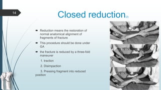 Non operative management of fractures | PPTX