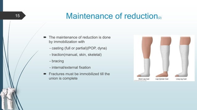 Non operative management of fractures | PPTX
