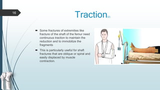 Non operative management of fractures | PPTX