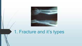 Non operative management of fractures | PPTX