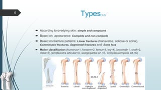 Non operative management of fractures | PPTX