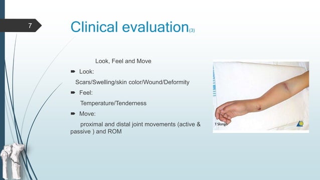 Non operative management of fractures | PPTX