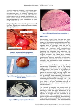 Non-pancreatic_retroperitoneal_pseudocyst_a_rare_c.pdf