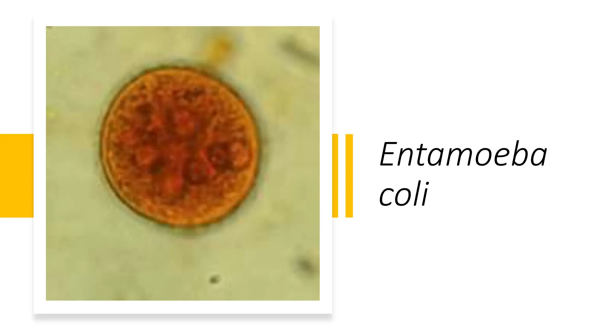 Non-pathogenic Amoeba. protozoa in the ameba group inhabit human ...