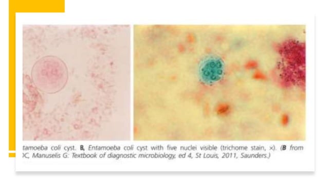 Non-pathogenic Amoeba. protozoa in the ameba group inhabit human ...