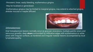 Non plaque induced gingival diseases | PPTX