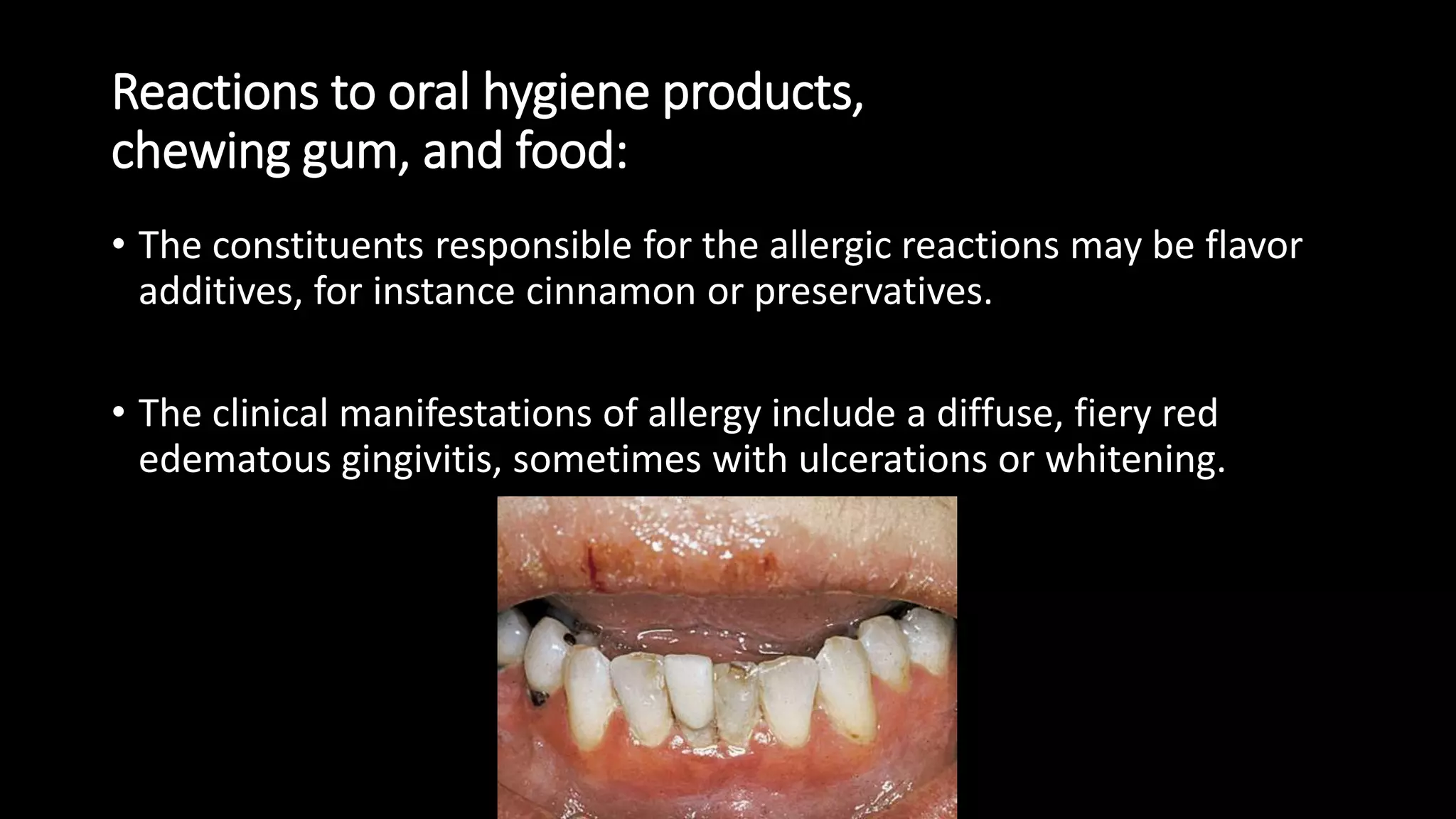 Non plaque induced gingivitis | PPTX