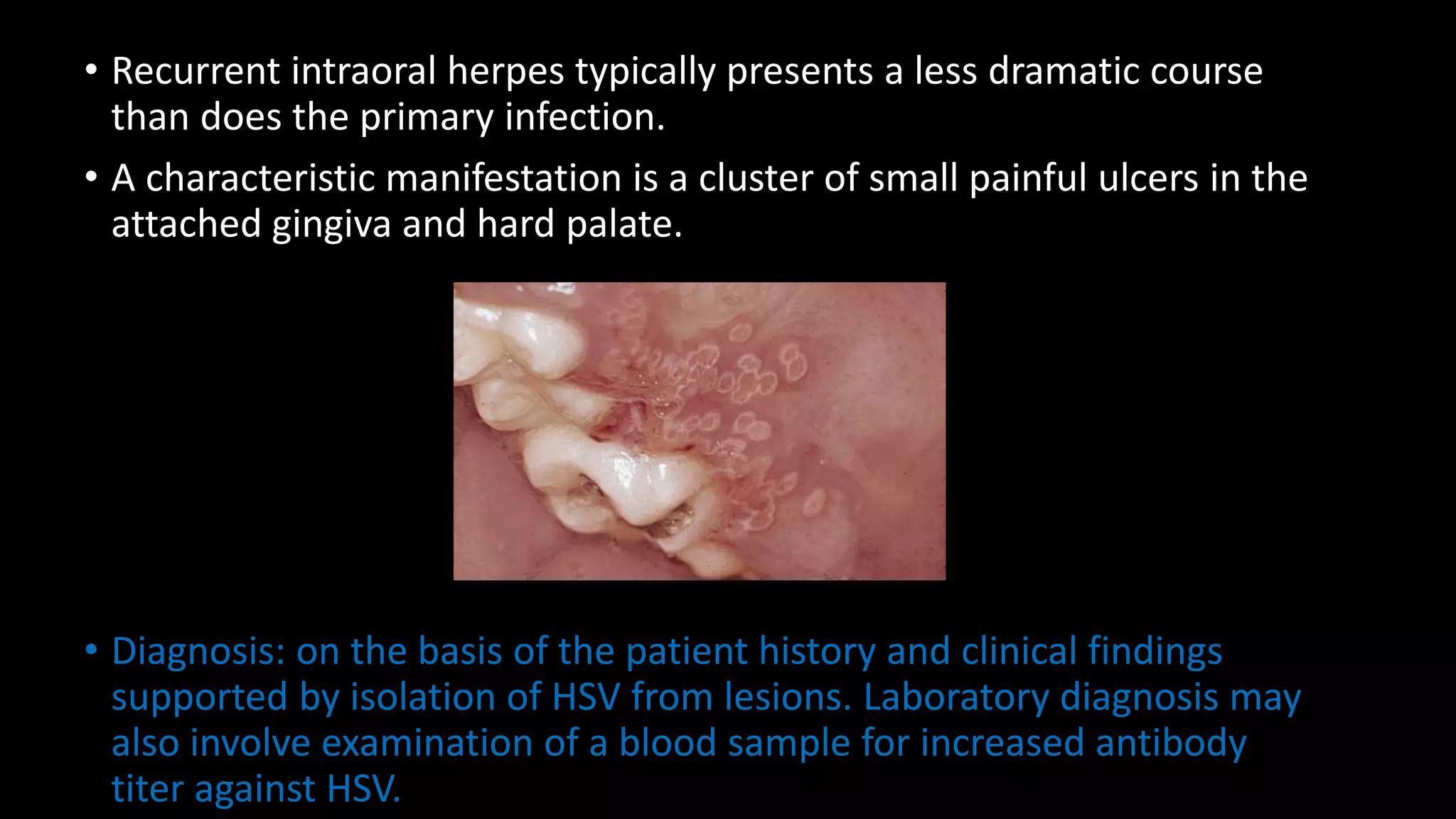 Non plaque induced gingivitis | PPTX