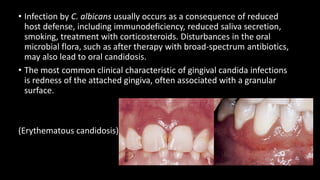 Non plaque induced gingivitis | PPTX