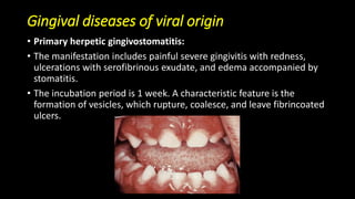 Non plaque induced gingivitis | PPTX