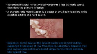 Non plaque induced gingivitis | PPTX