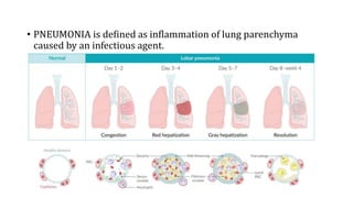 NON-RESOLVING PNEUMONIA.pptx