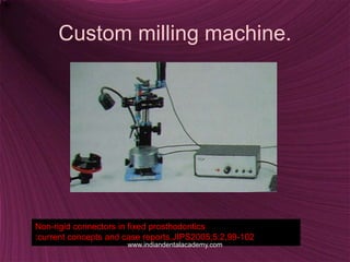 Non rigid connectors in fixed prosthesis / cosmetic dentistry training ...