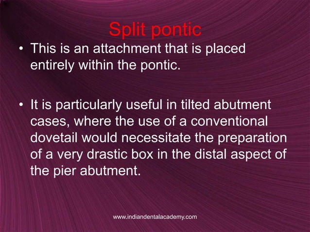 Non rigid connectors in fixed prosthesis / cosmetic dentistry training